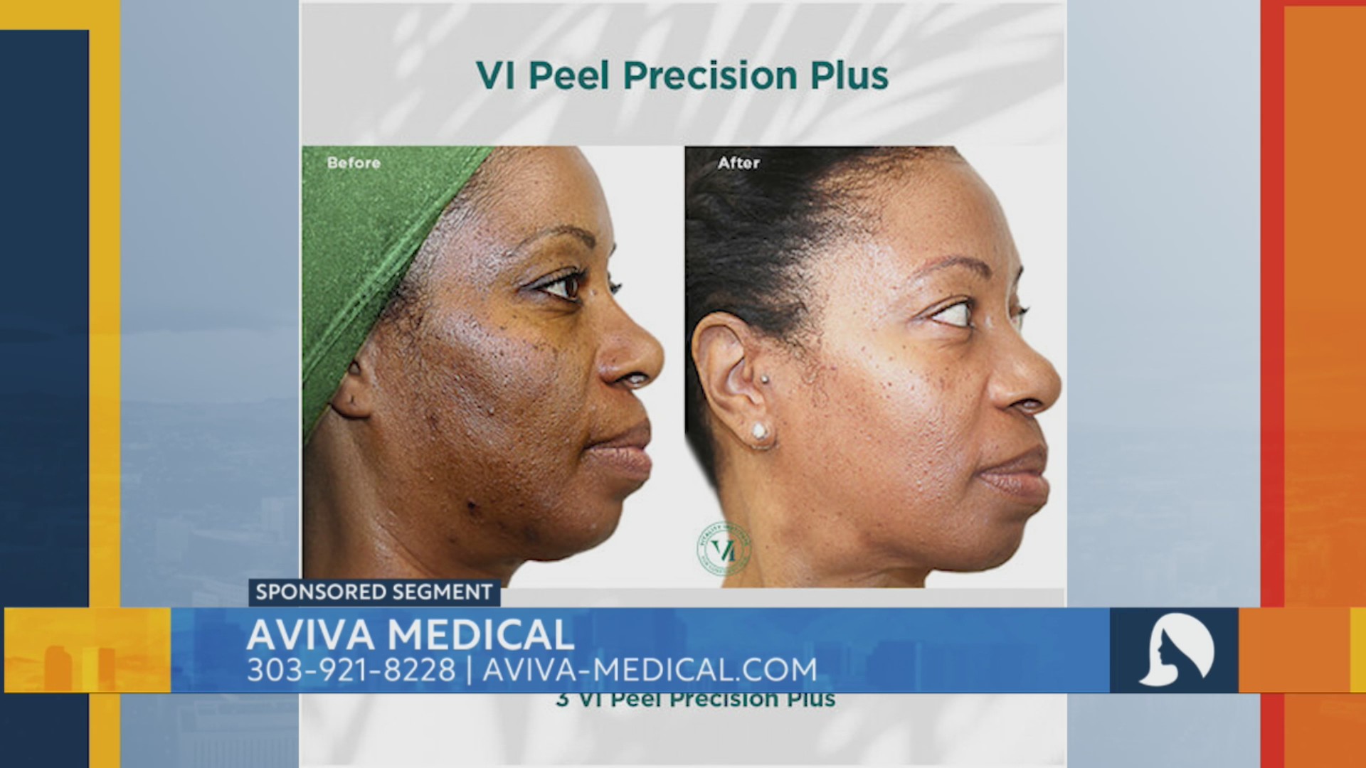 avIVa Medical: Facial Treatments – FOX31 Denver