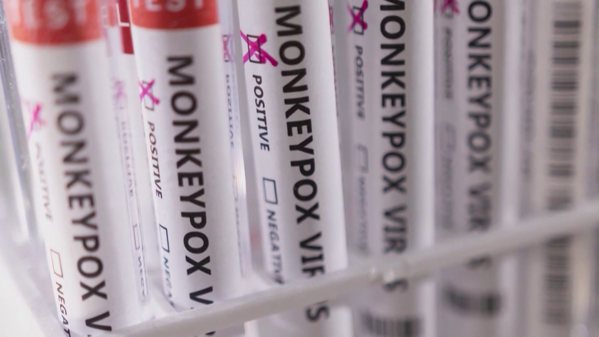 2 Chicago residents die after monkeypox diagnosis – WGN-TV