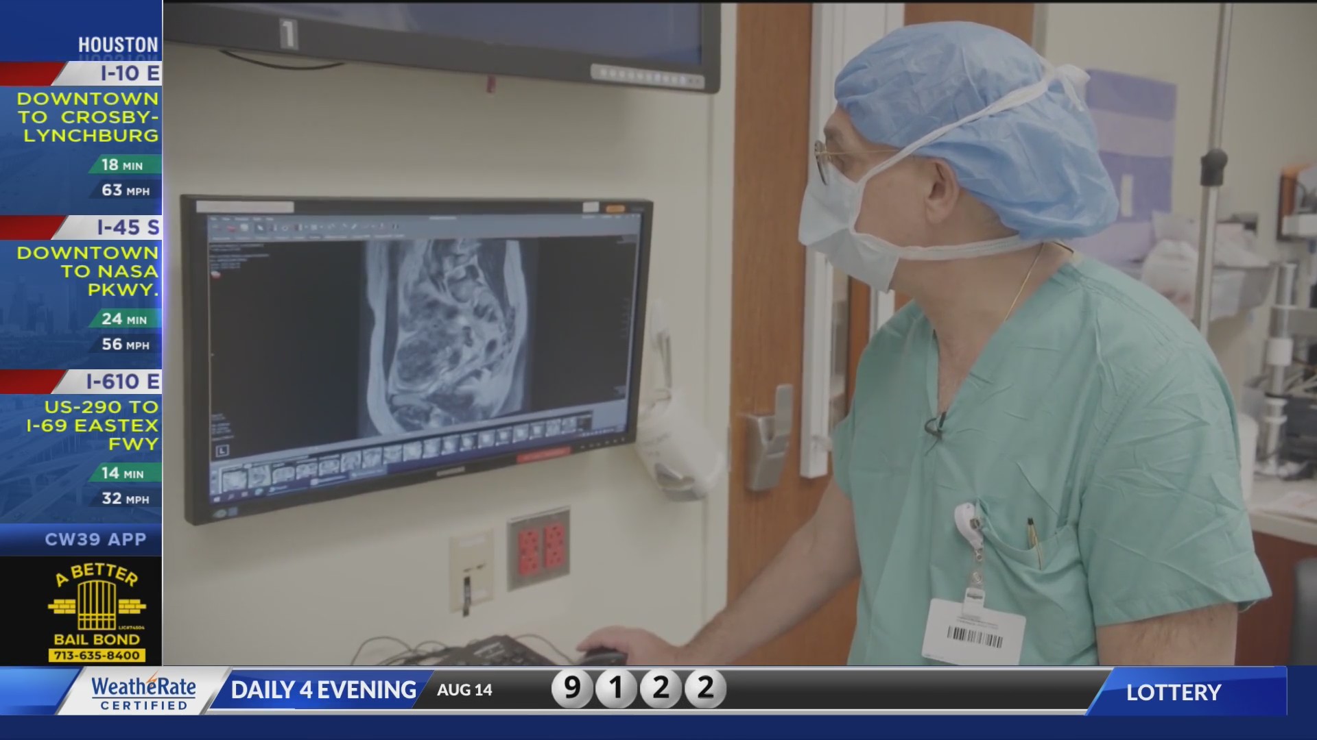 Novel approach to fibroids losses less blood, has better outcomes ...