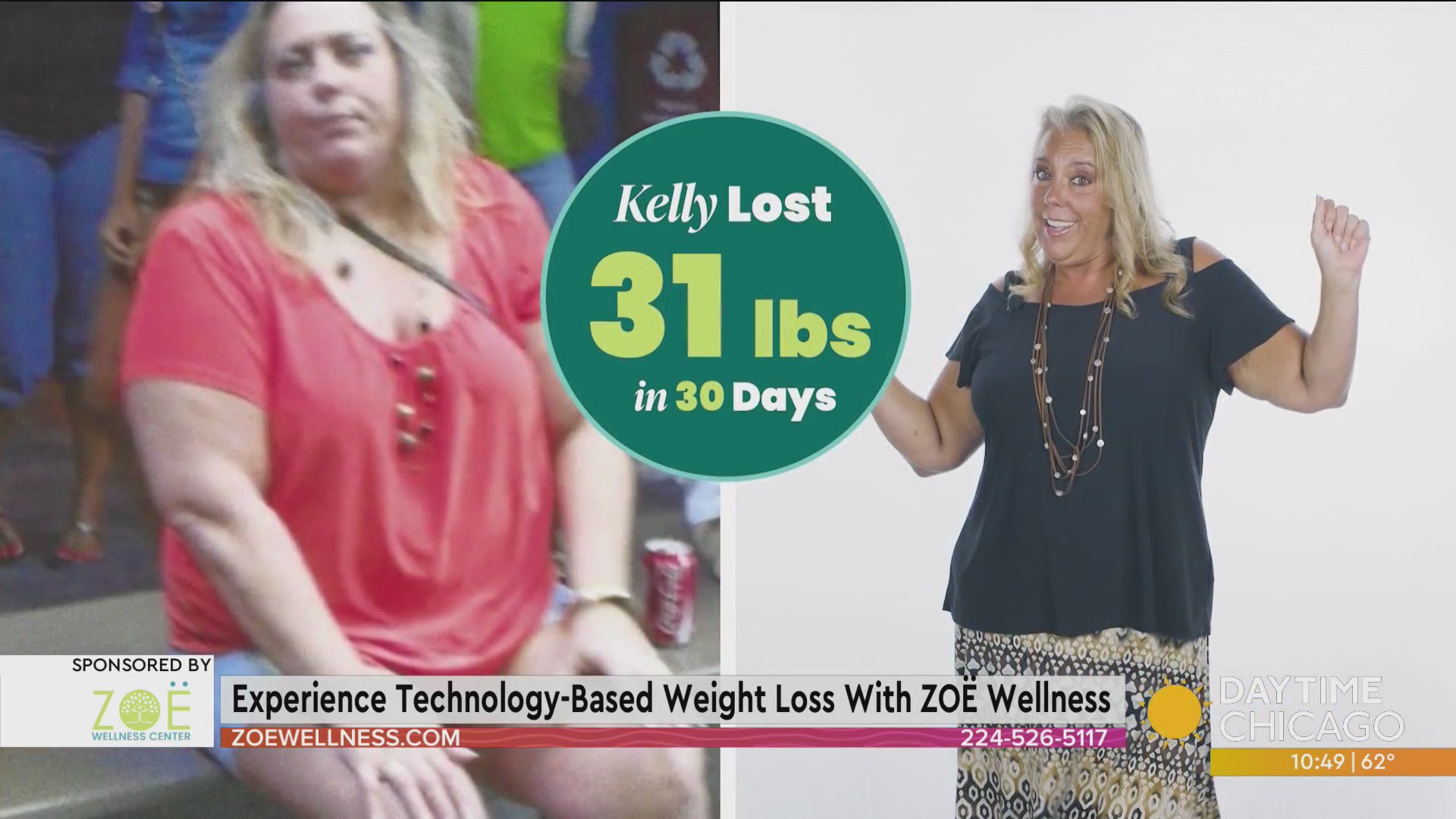 Experience Technology-Based Weight Loss With ZOË Wellness – WGN-TV