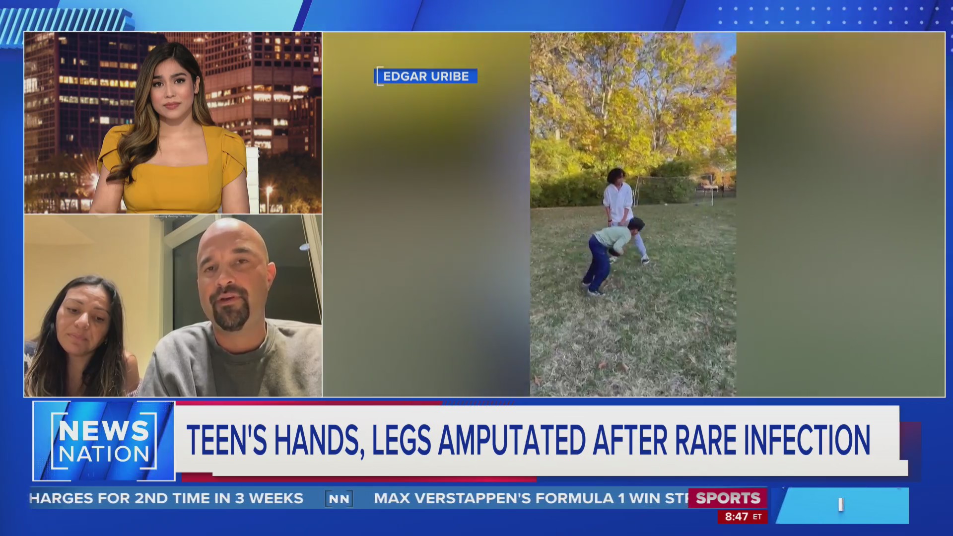 Teen’s hands, legs amputated after rare infection | NewsNation Prime ...