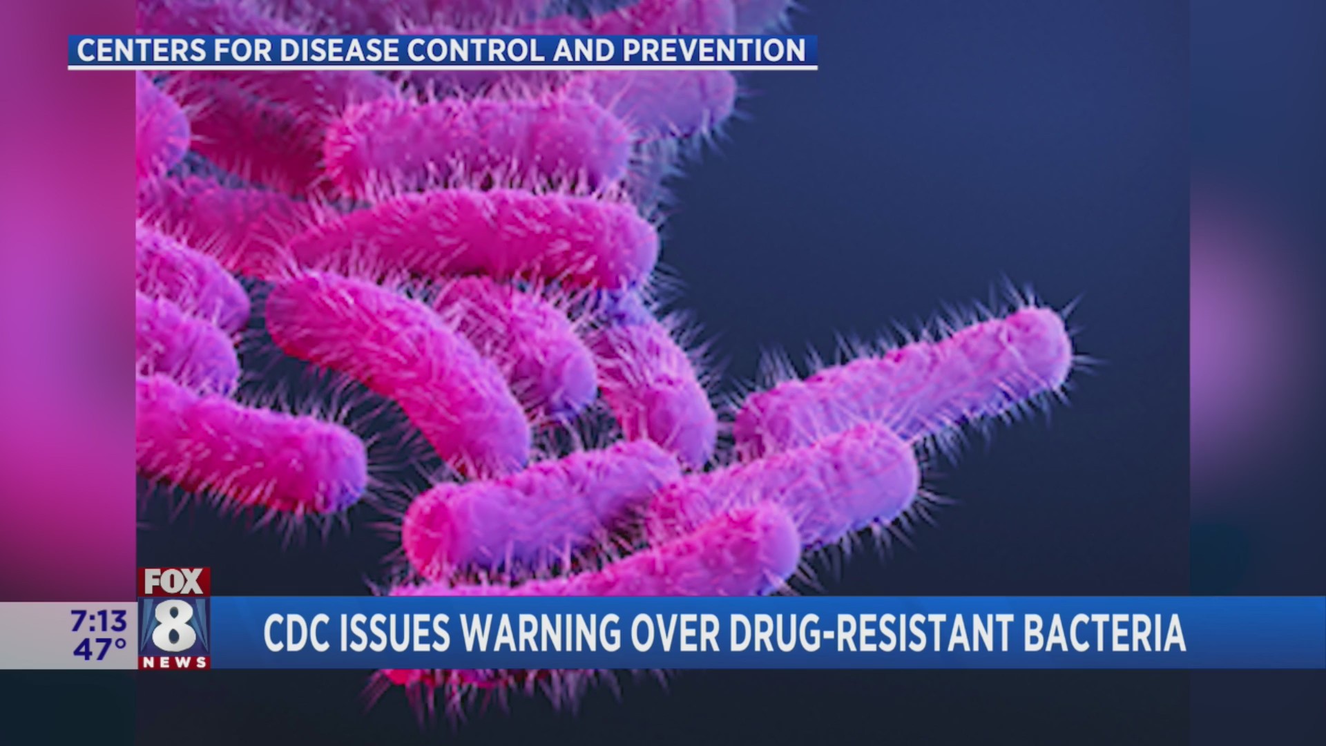 Cdc Warns Of Drug Resistant Stomach Bug Fox 8 Cleveland Wjw