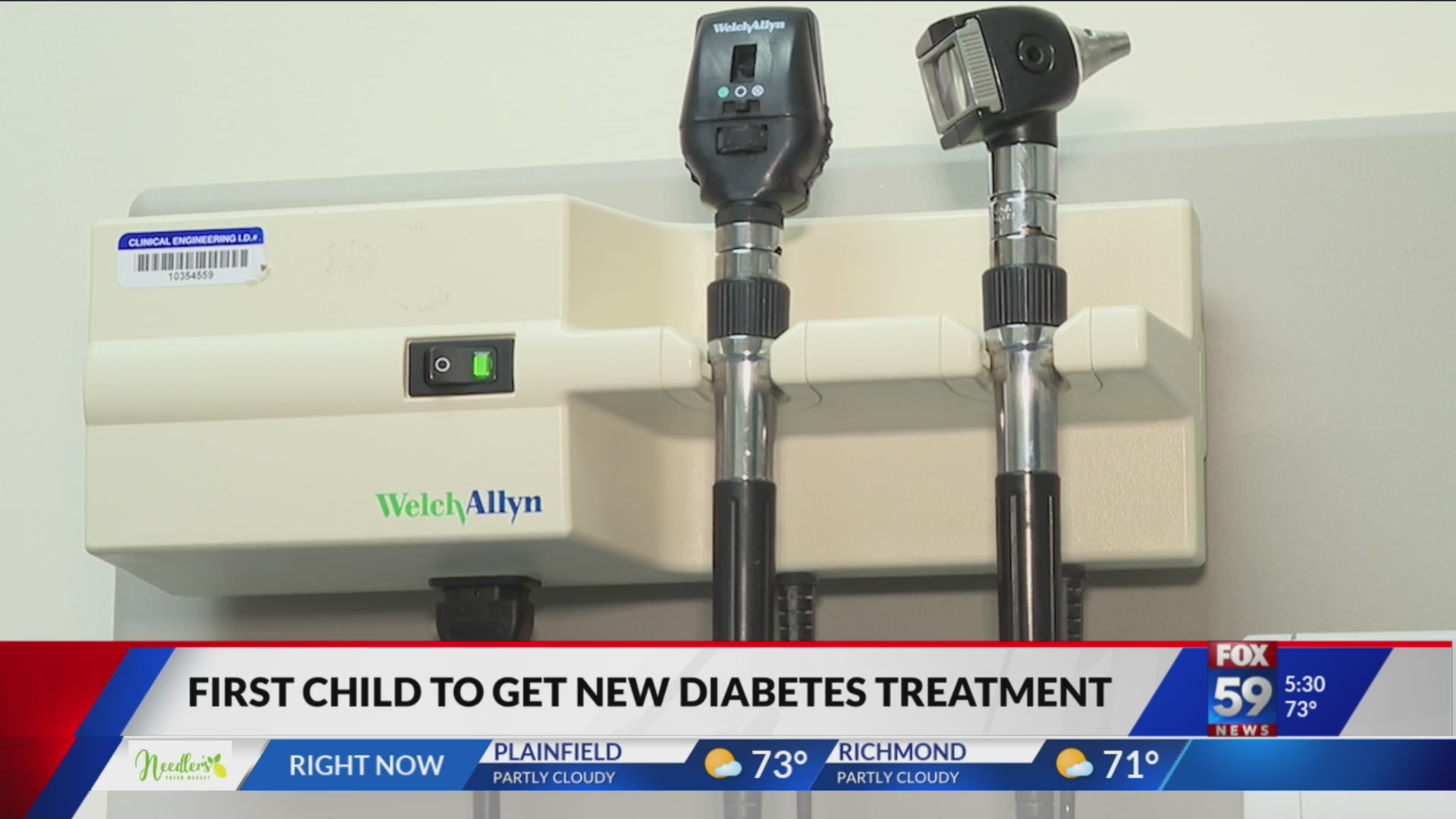 First child to get new diabetes treatment – Fox 59