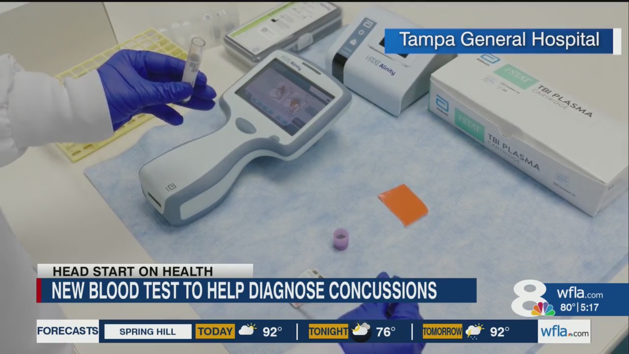 Blood test helps doctors quickly diagnose concussions – WFLA
