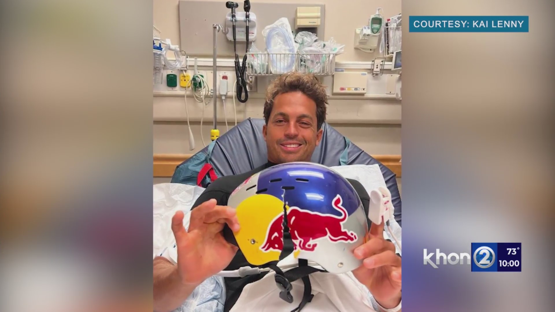 World champion surfer Kai Lenny holding his cracked helmet ‘It may have ...