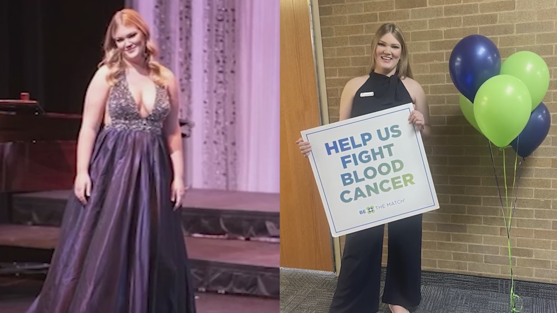 Miss Colorado contestant on a mission to cure cancer – FOX31 Denver