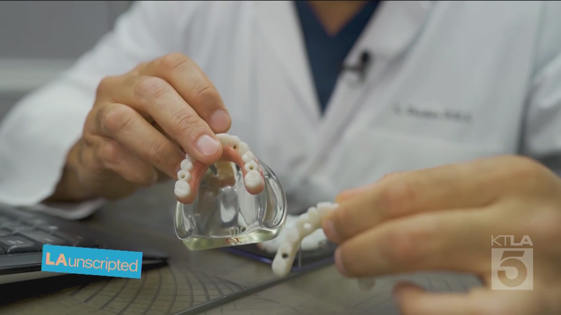 Infini Teeth are exclusively offered at Cunning Dental – KTLA