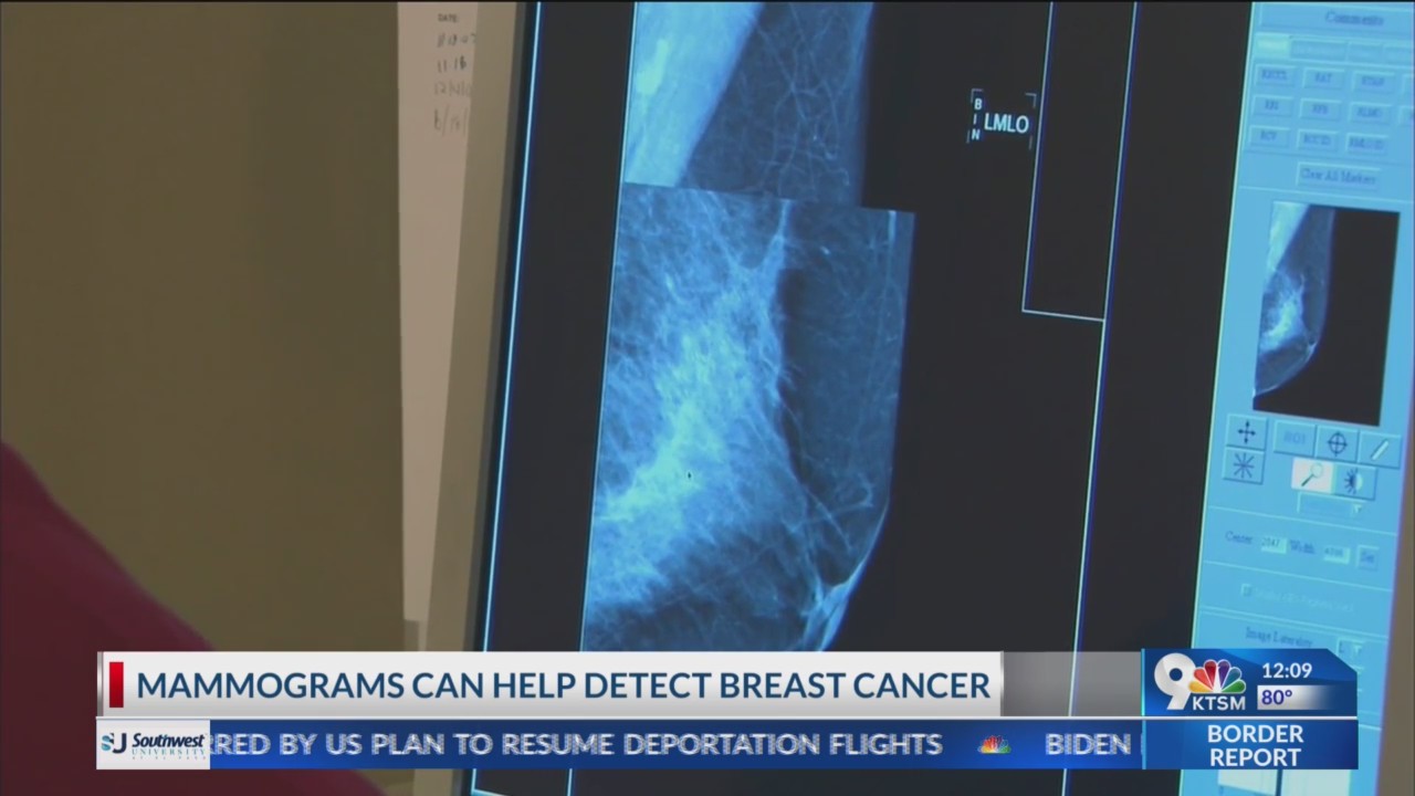Providence hospitals encourages early detection with special mammogram ...