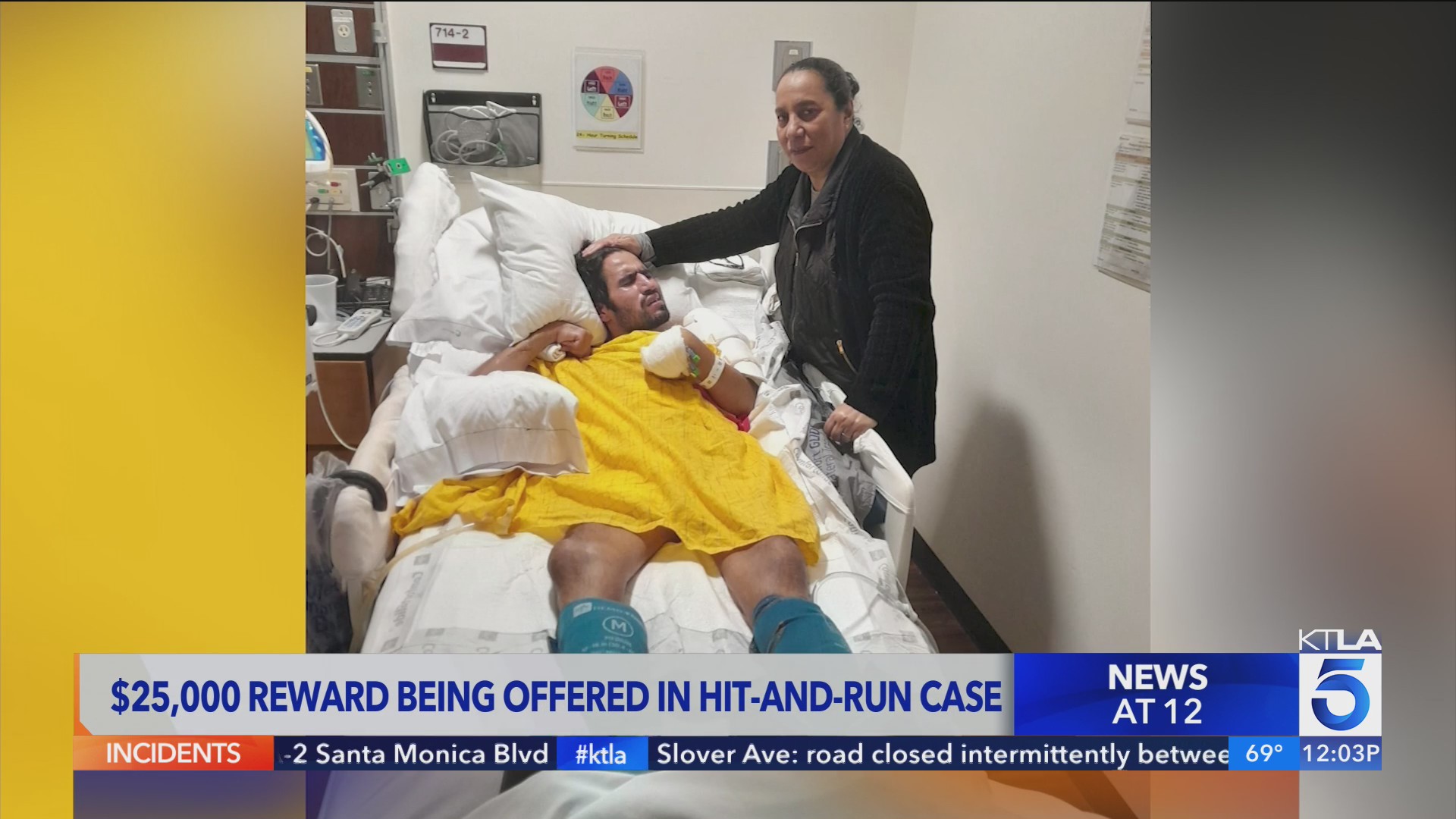 Man remains in coma 2 months after L.A. hit-and-run – KTLA