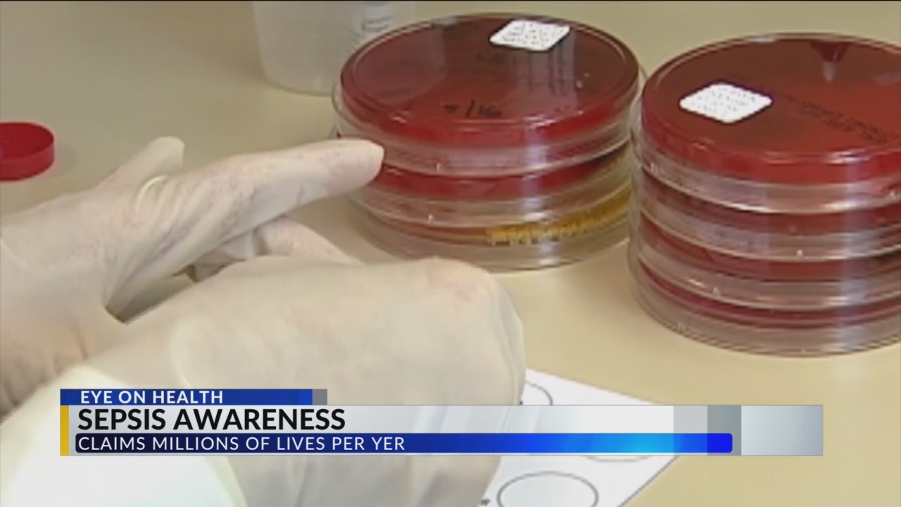 Eye on Health: Sepsis – KLFY.com