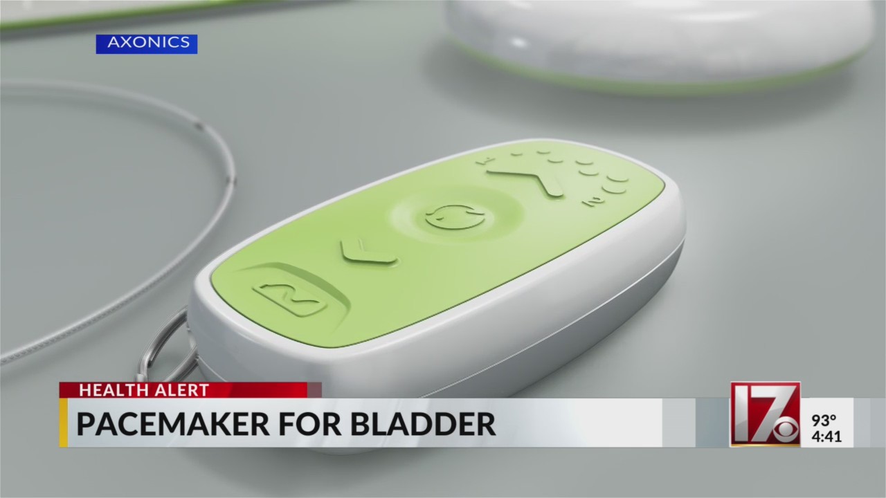 Bladder pacemaker helps Durham realtor regain normal control – CBS17.com