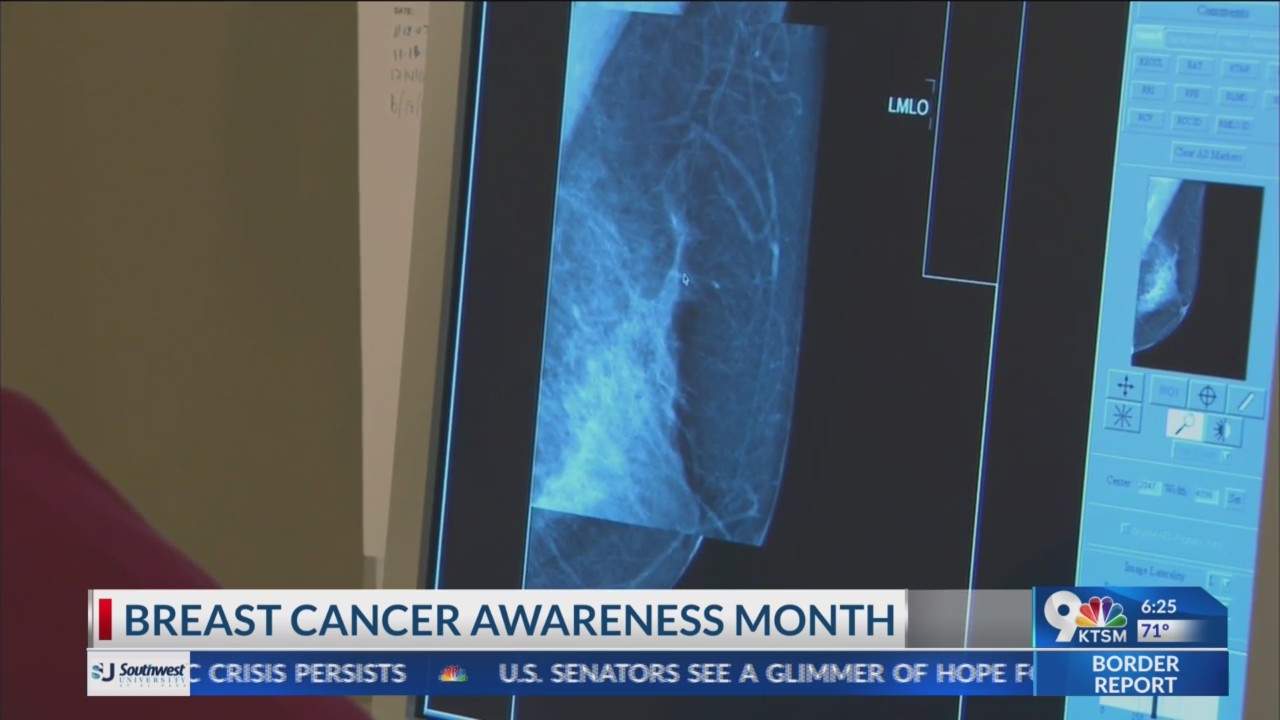 Providence hospitals encourages early detection with special mammogram ...
