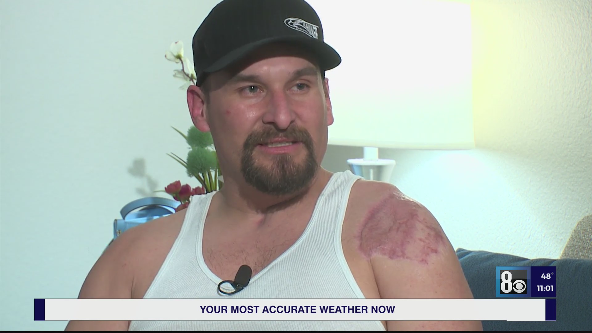 ‘I don’t know what happened’: Hit-and-run victim shares story after ...