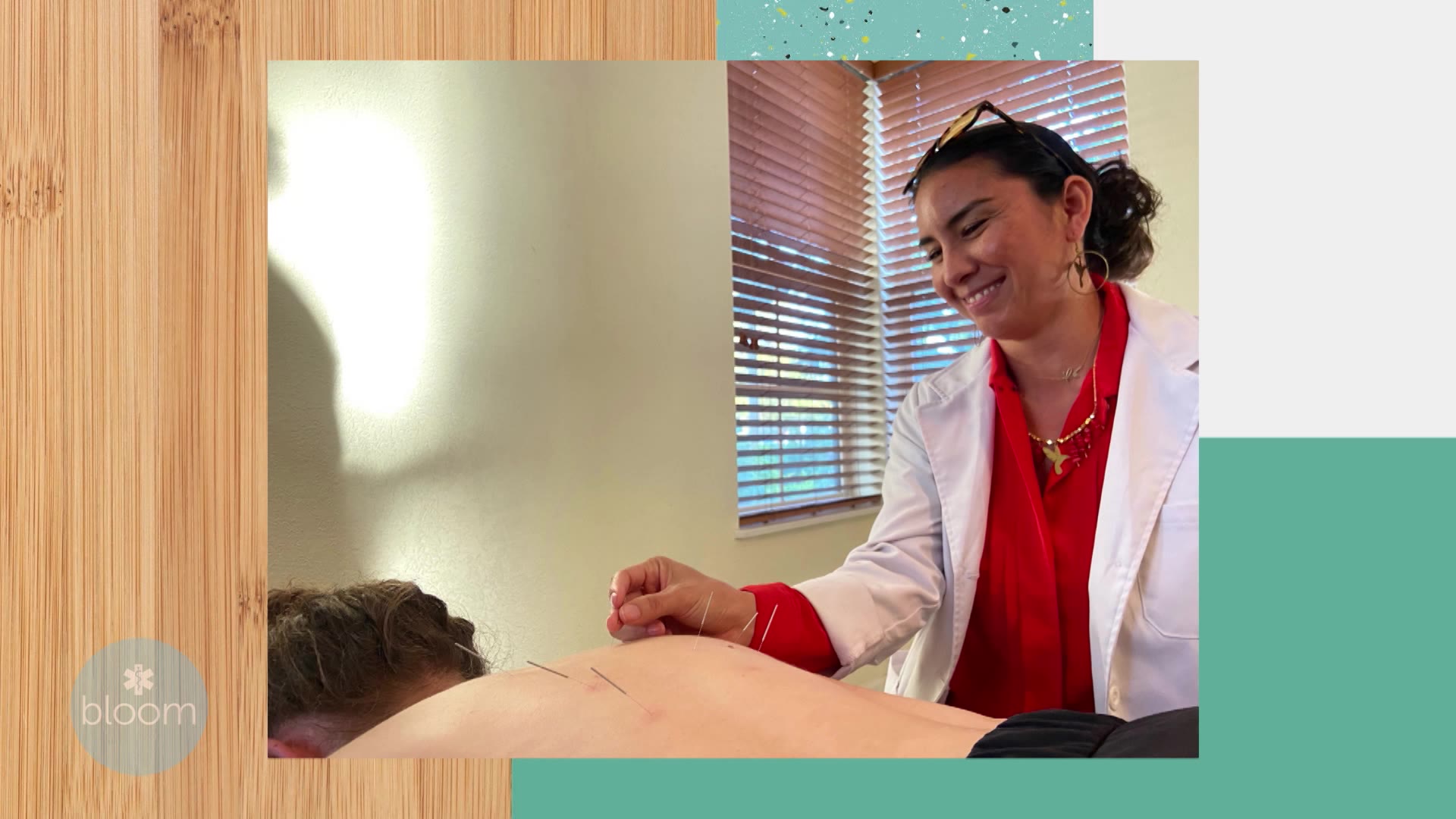 Acupuncture – WFLA