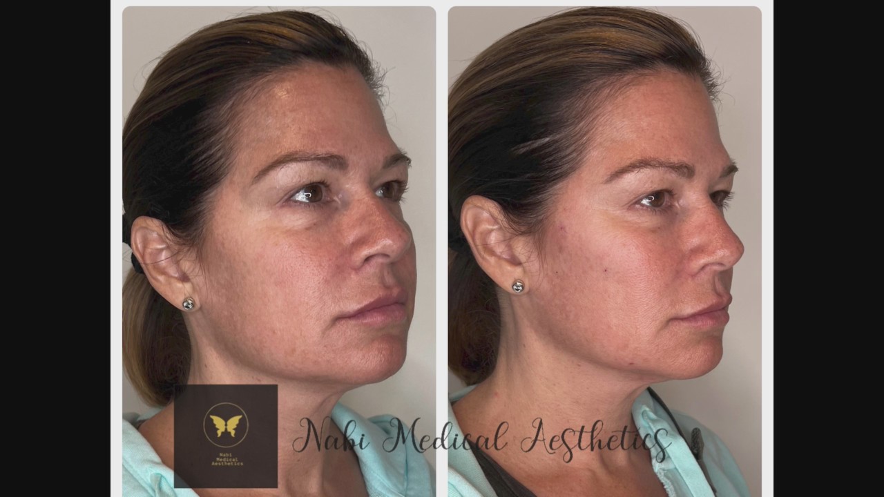 NABI’s PRF Gel is an all-natural way to look your best – PAhomepage.com