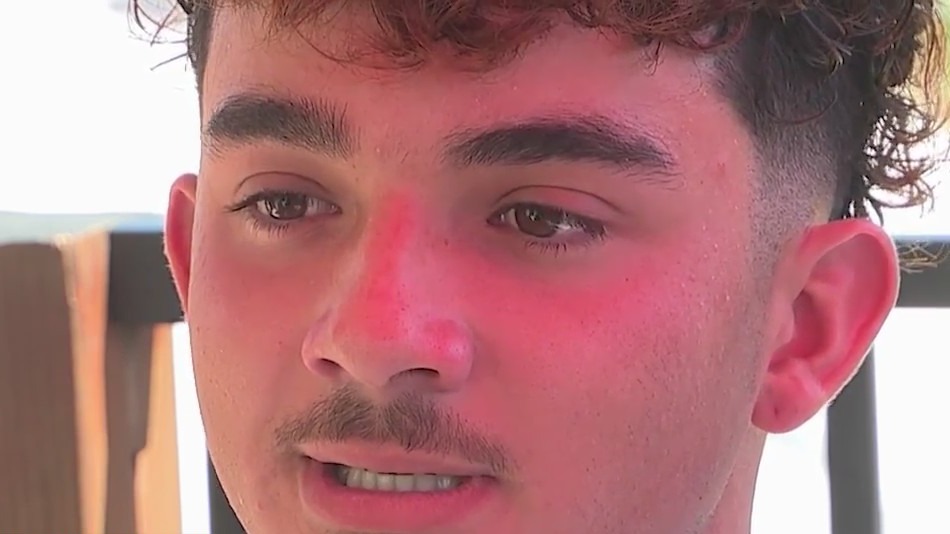 High school baseball standout has hand amputated after fireworks ...