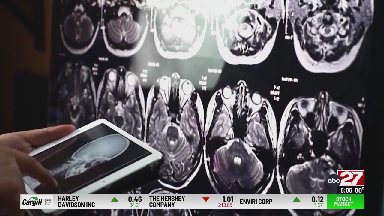 World Alzheimer’s Awareness Month – PAhomepage.com