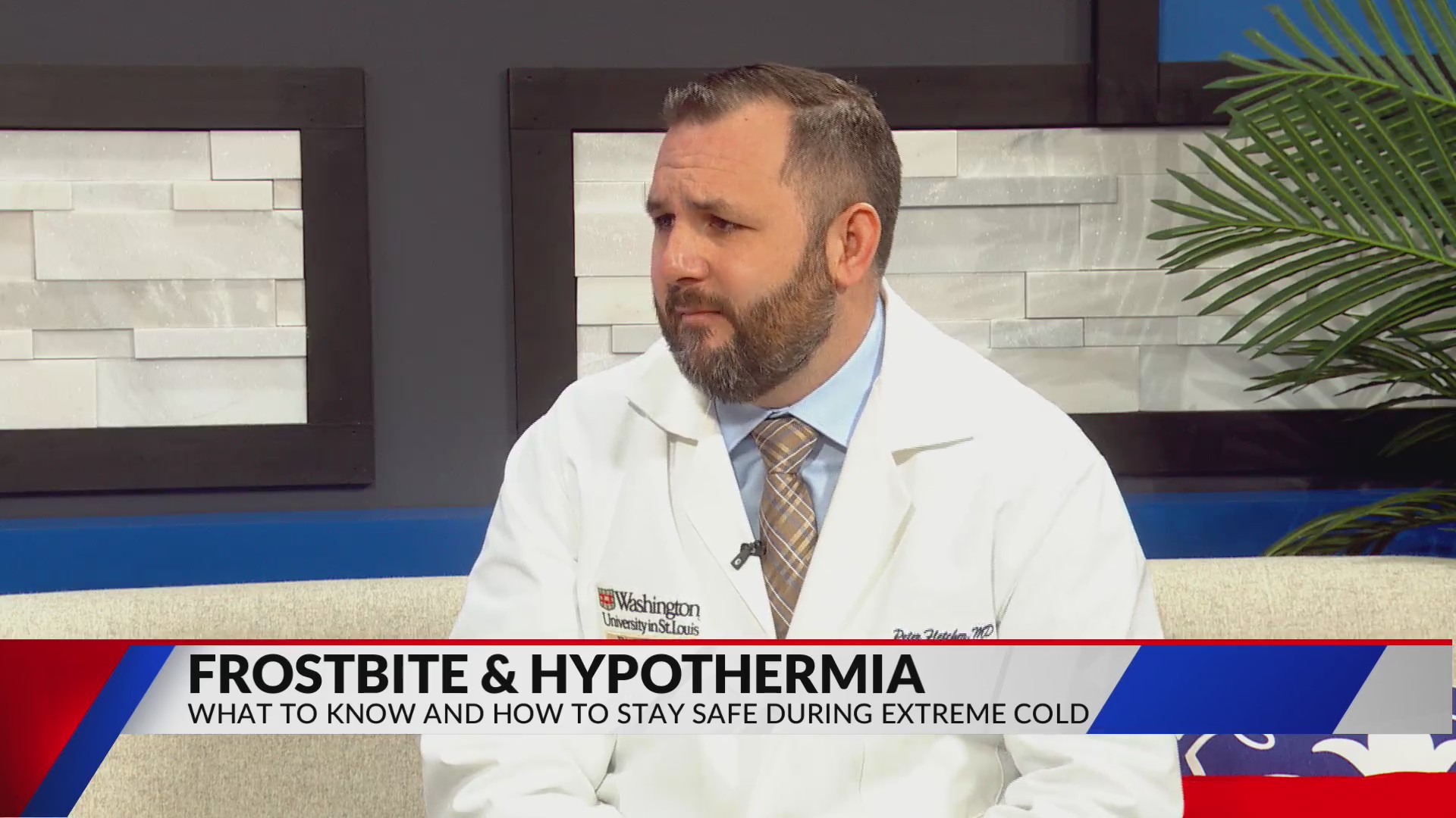 Frostbite & Hypothermia – FOX 2