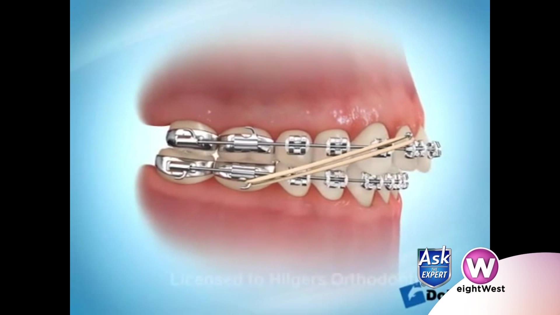 The importance of correcting your bite – WOODTV.com