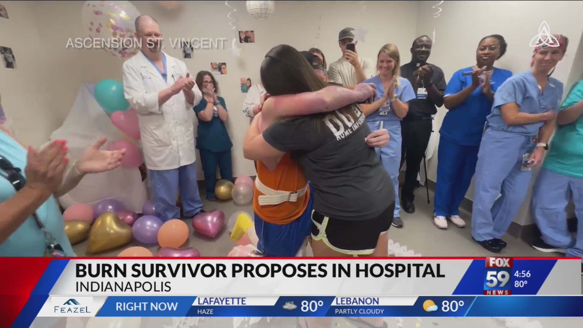 Indianapolis burn survivor proposed to girlfriend in Burn ICU – Fox 59