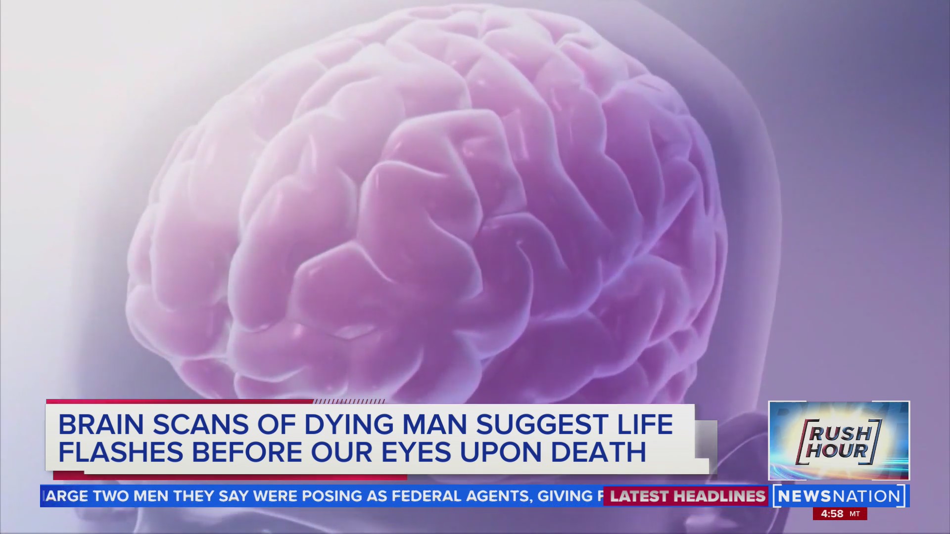 Brain scans of dying man suggest life flashes before eyes upon death ...