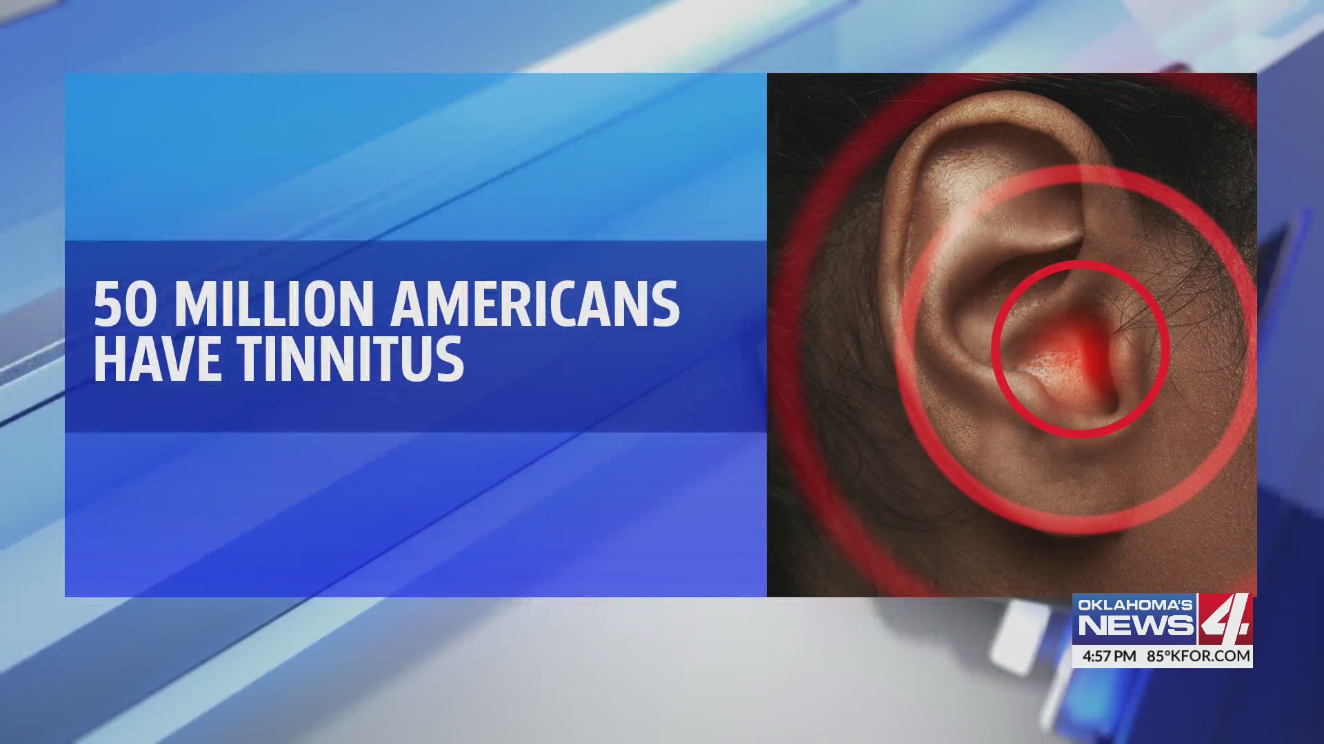 Drug offers hope for people suffering from tinnitus – KFOR.com Oklahoma ...