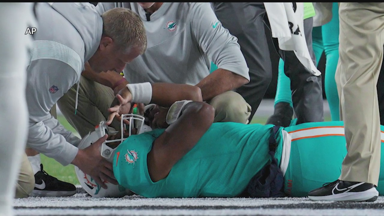 Dr. Stephanie Kopey says concussions need to be watched closely – WKBN.com