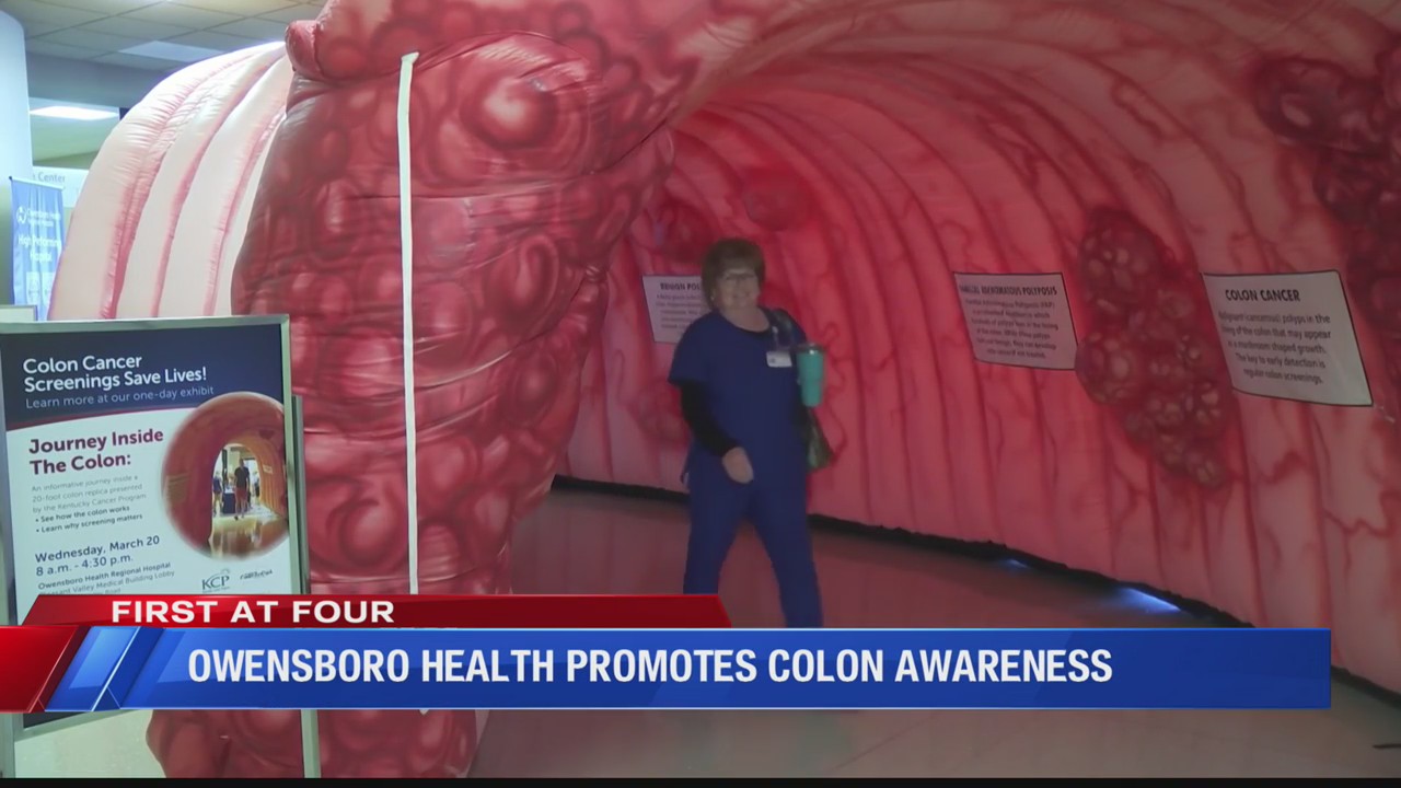 Owensboro Health Uses Inflatable Colon to Promote Cancer Awareness ...