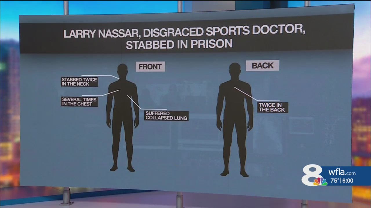 Larry Nassar stabbed 10 times at Florida Prison – WFLA