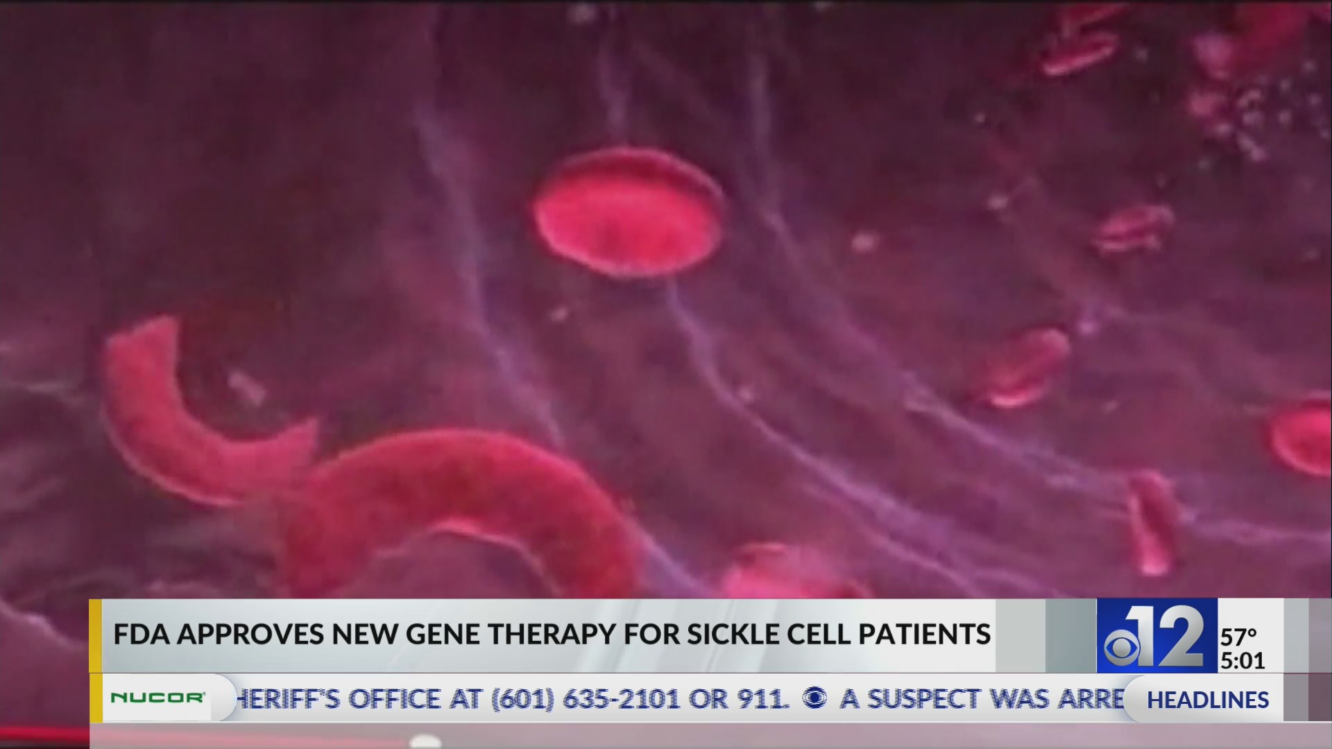 FDA approves new sickle cell treatments – WJTV