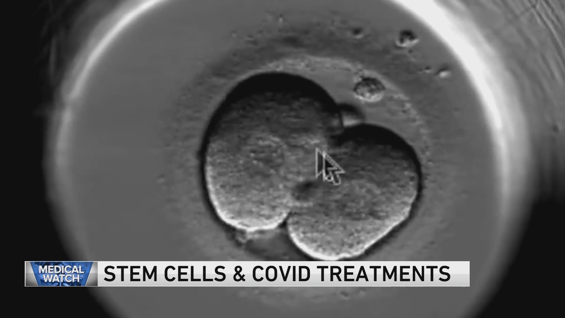 MedWatch Digest: Positive parenting, probiotic depression and stem ...