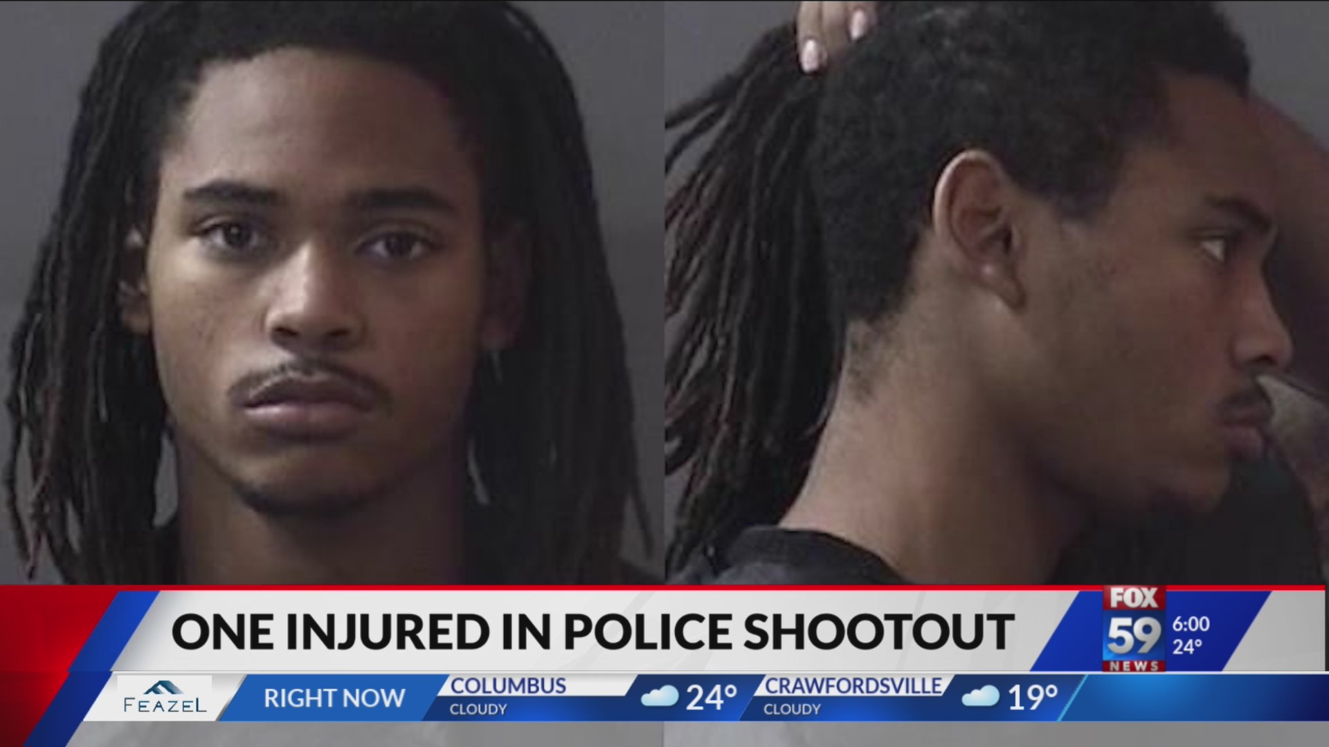 Suspect remains in critical condition after gunfight with Indianapolis ...