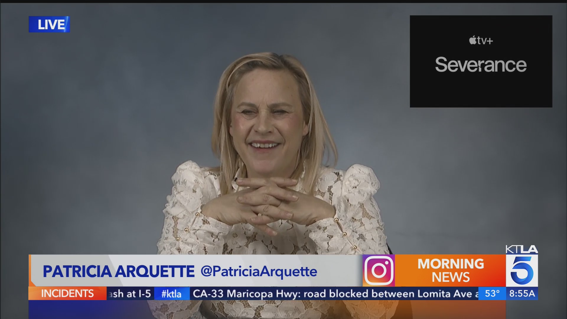 Patricia Arquette talks about the ‘different tone’ of ‘Severance’ – KTLA