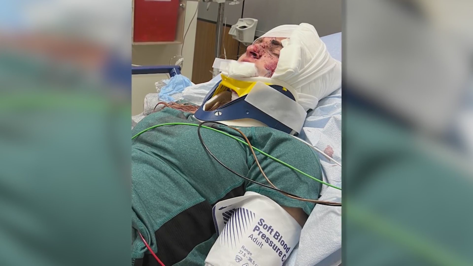 Thornton woman survives 200-foot fall down California mountain – FOX31 ...