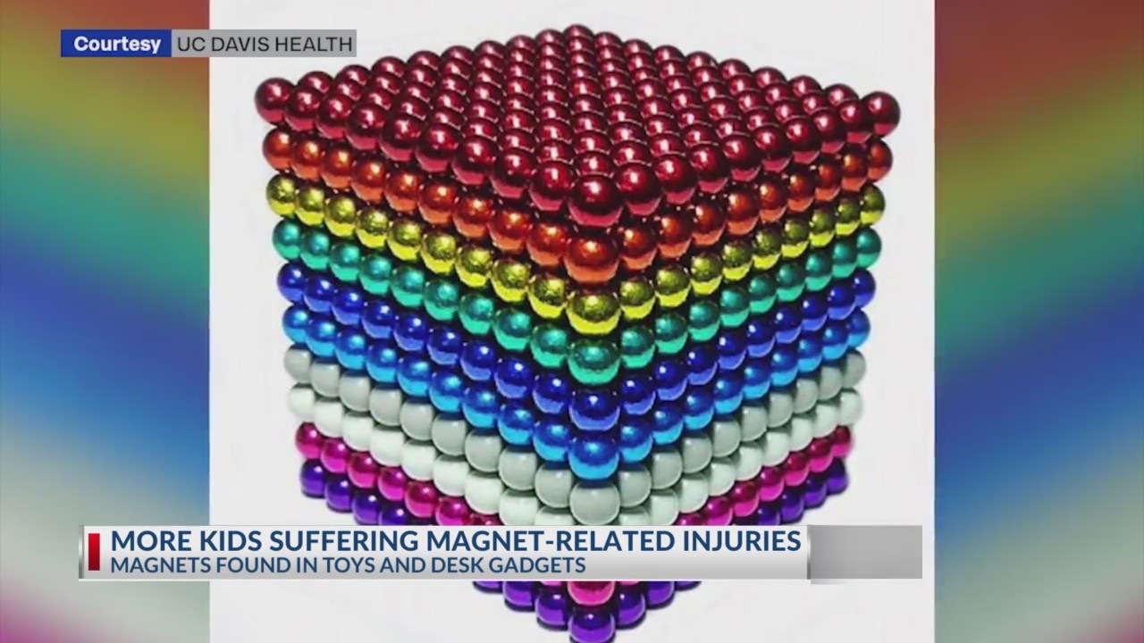 Doctors warn against magnet injuries in children – NBC4 WCMH-TV