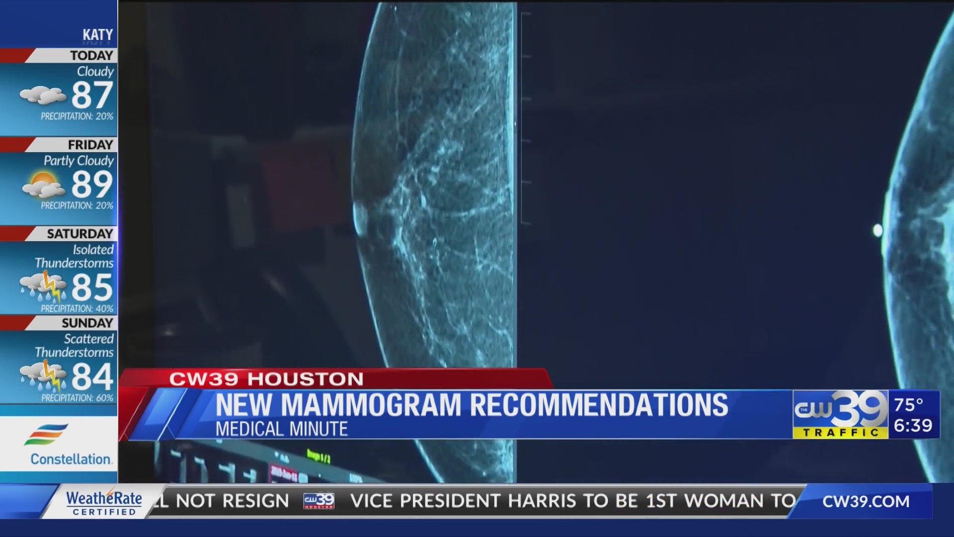 Women should start mammograms at 40 not 50 – Medical Minute, Idolina ...