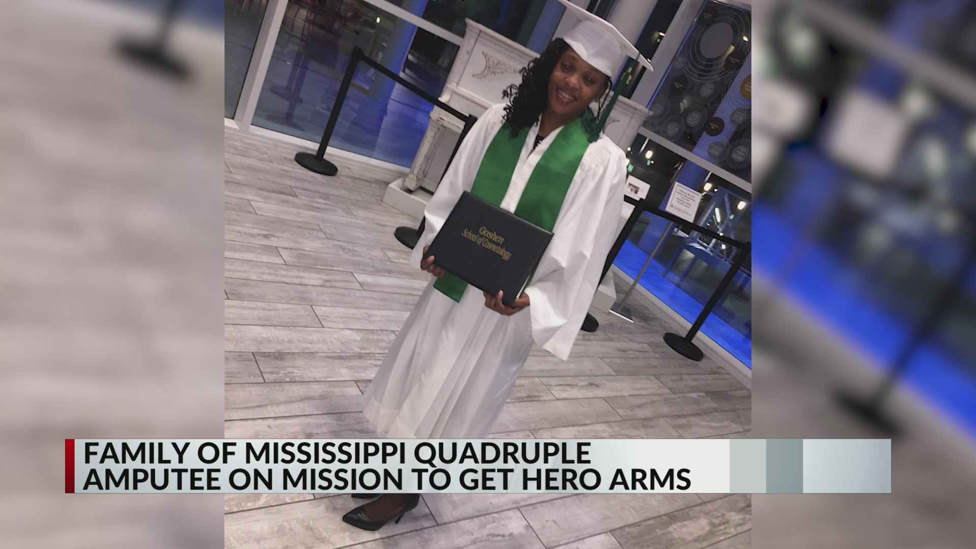 MS woman a quadruple amputee at age 44 – FOX 56 News