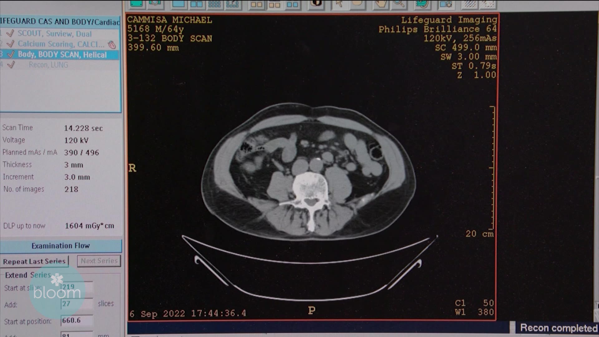 Early Detection Saves Lives with Life Guard Imaging – WFLA