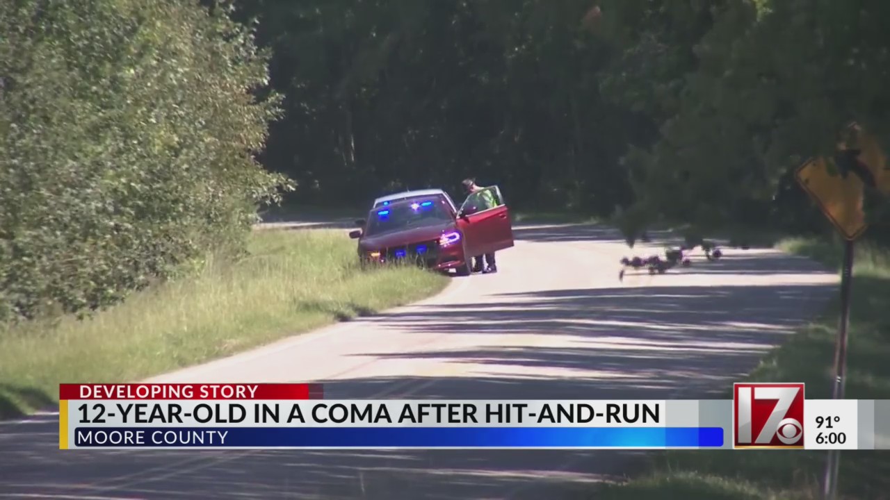 12-year-old in a coma after hit and run – CBS17.com