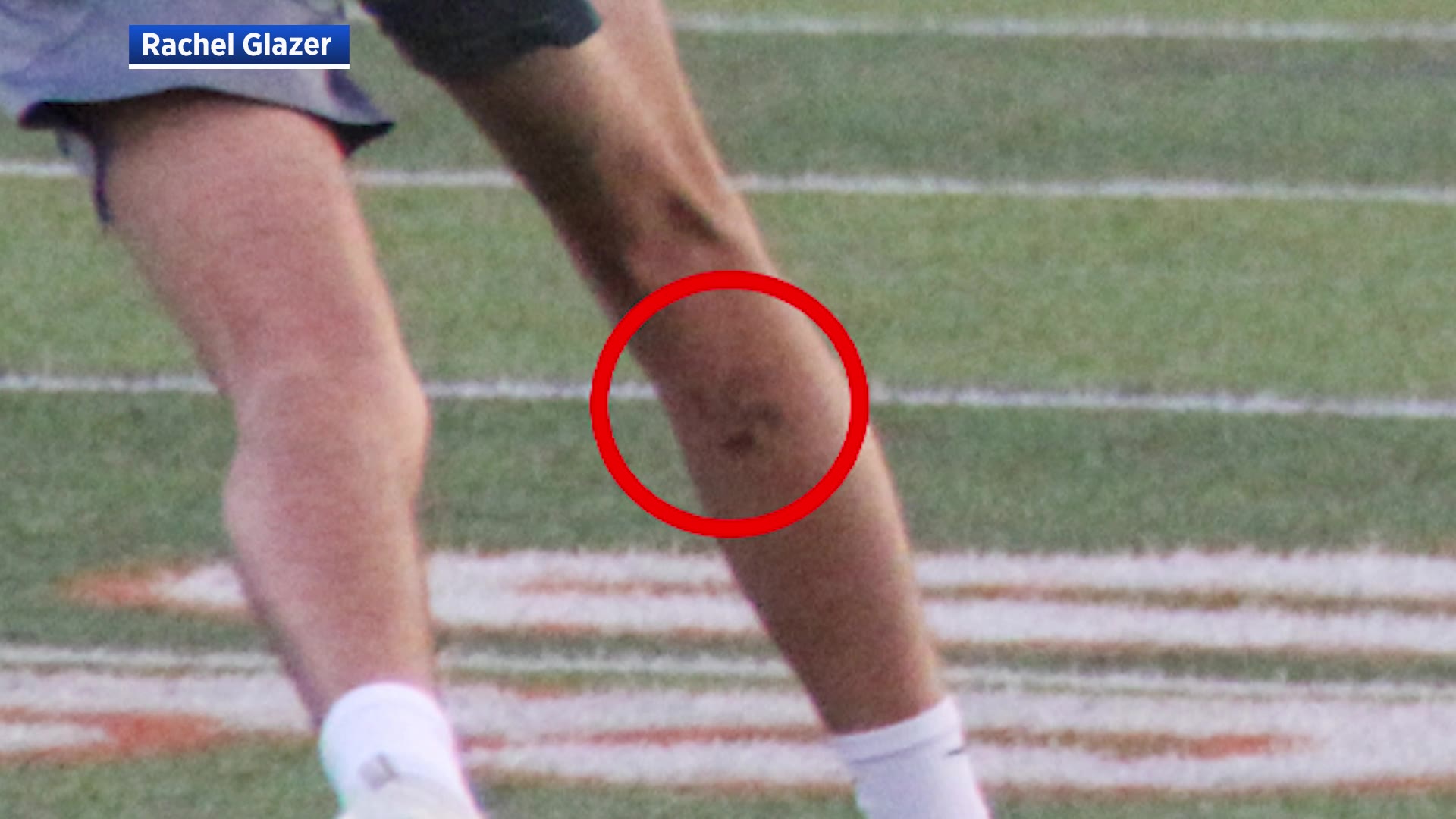 Catholic student had swastika on leg during Ohio high school lacrosse ...