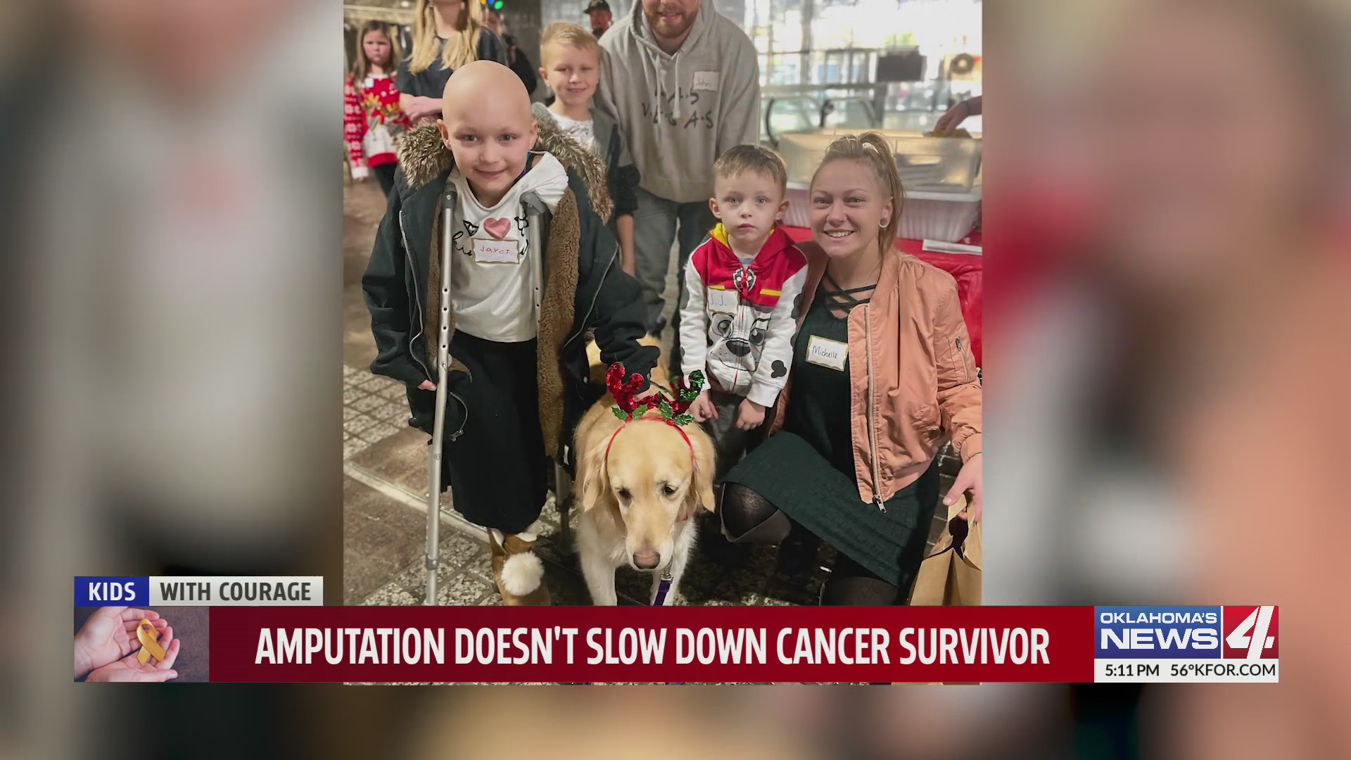 Amputation doesn’t slow down cancer survivor – KFOR.com Oklahoma City