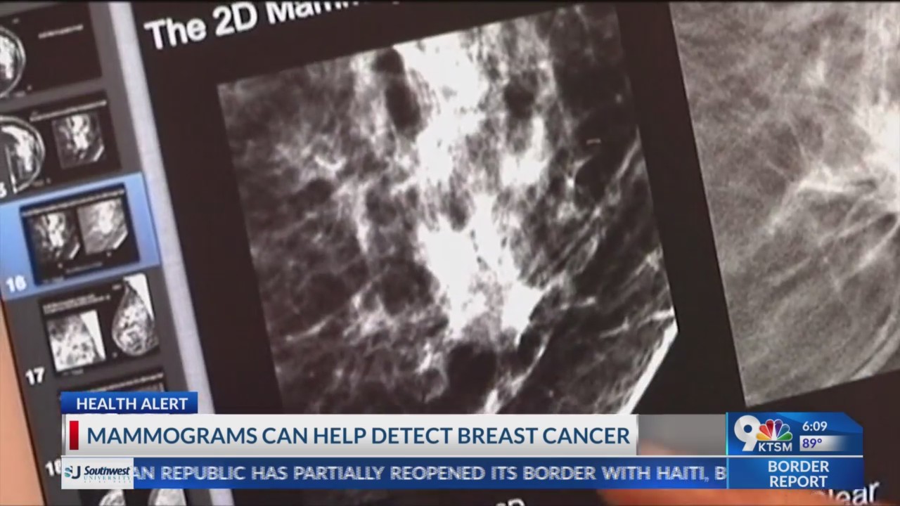 Mammogram screening – KTSM 9 News