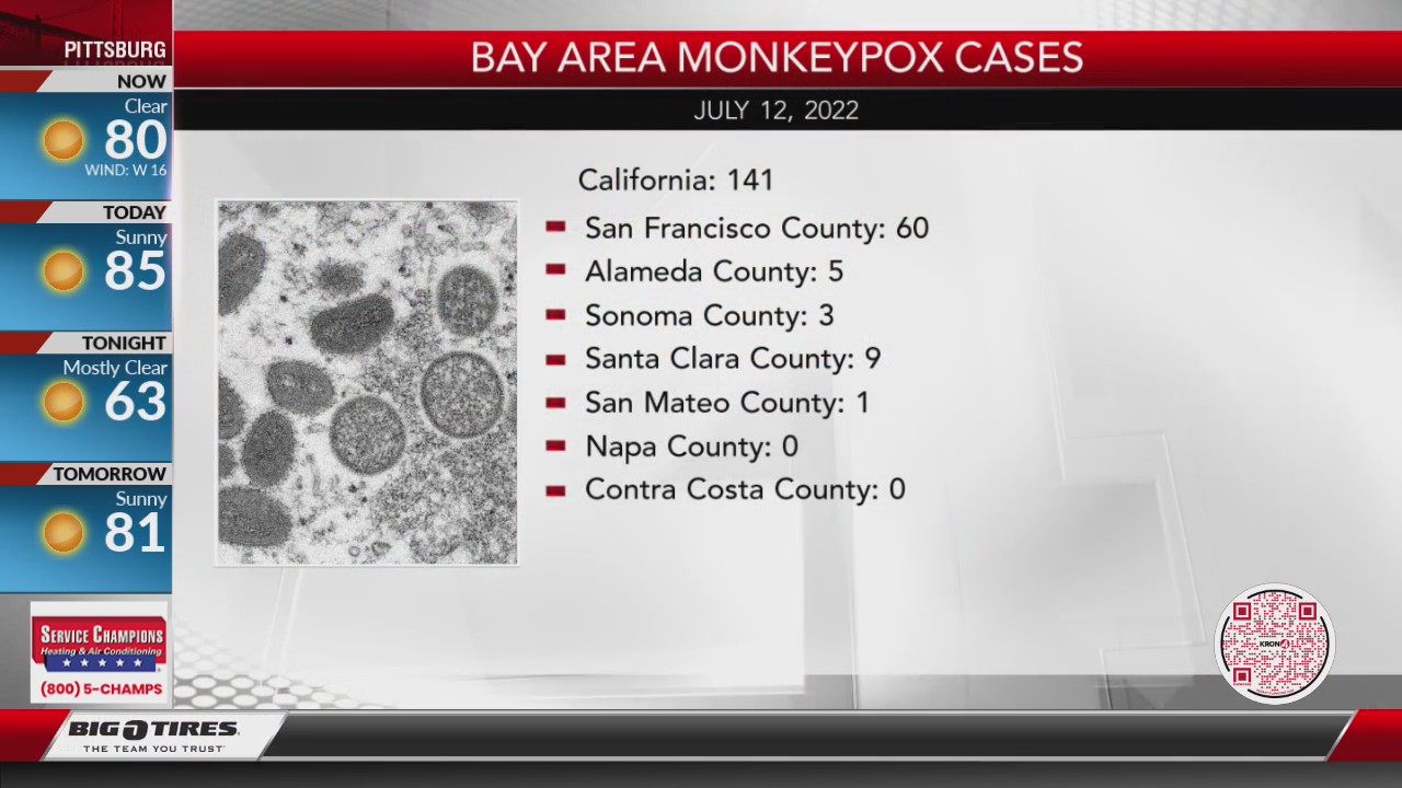 Bay Area Monkeypox cases – KRON4