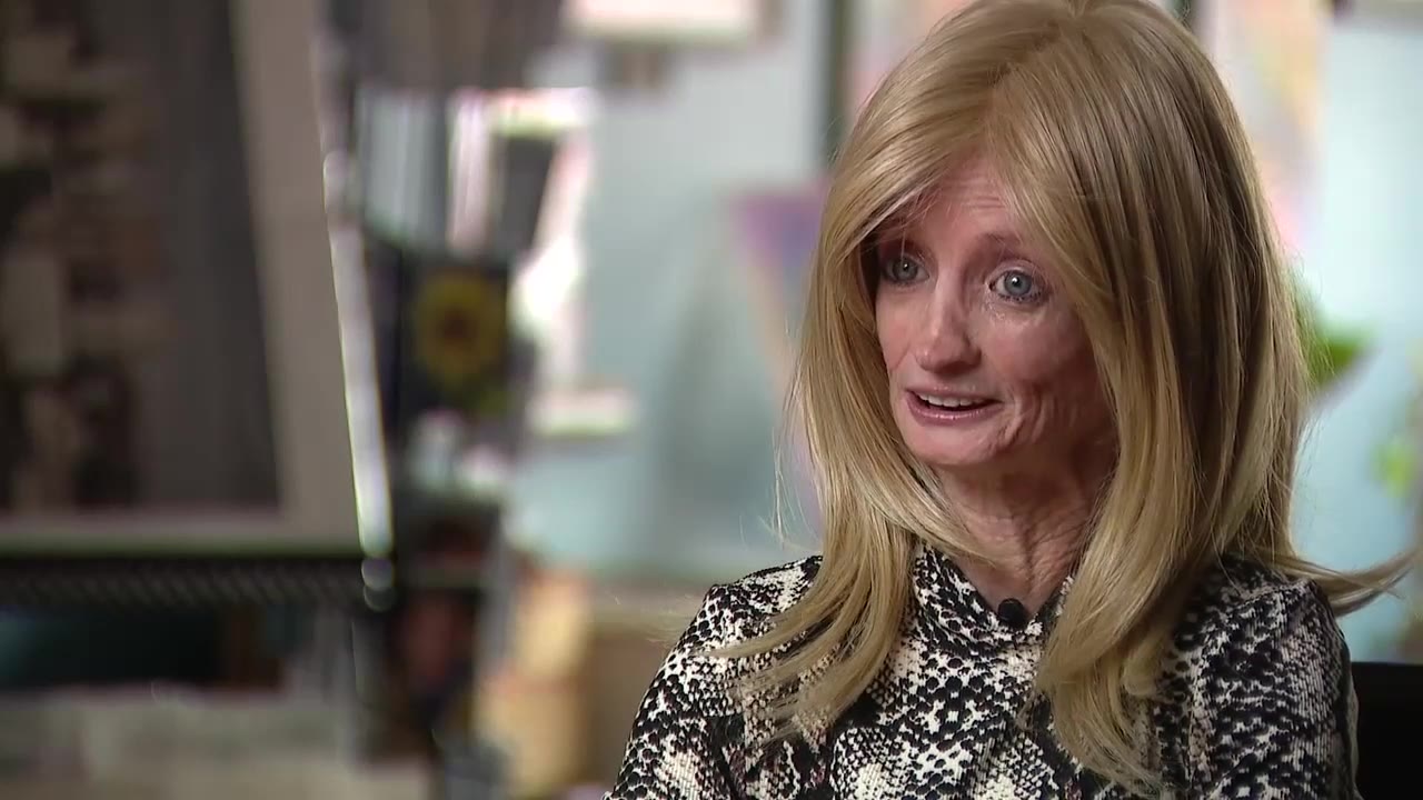 Ohio woman shares battle with rare disease that causes rapid aging ...