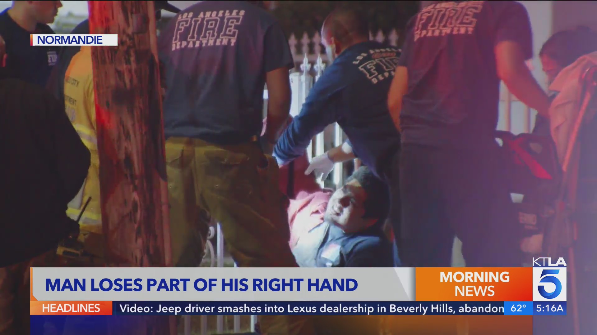 Man loses part of hand, house catches fire amid July 4 fireworks ...