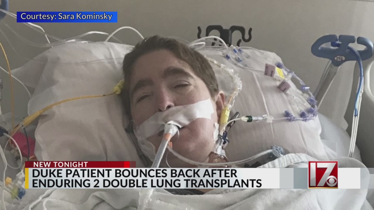 Woman reflects on 2nd double lung transplant, as Duke marks 10,000th ...