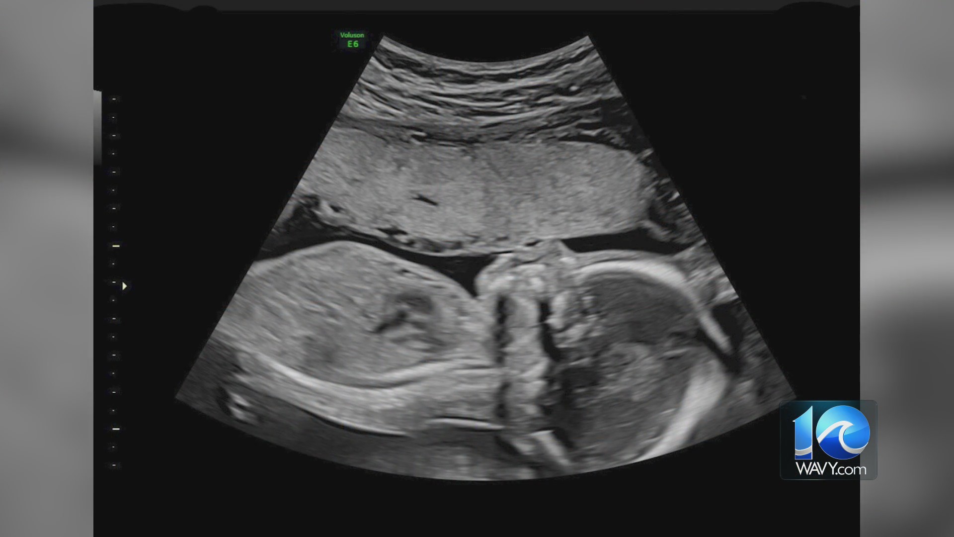 Baby announcement – Congrats Madison Pearman! – WAVY.com