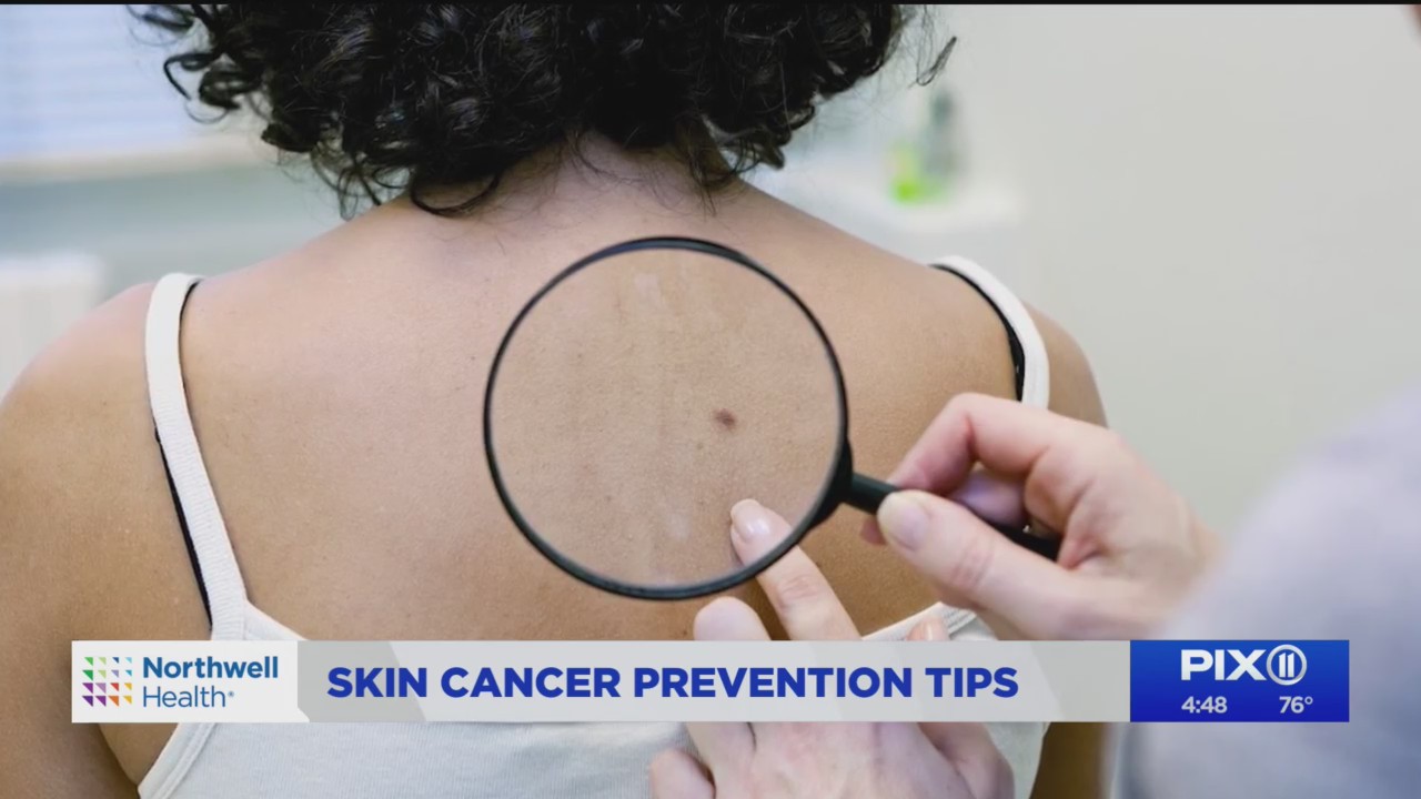 Skin cancer prevention tips – PIX11