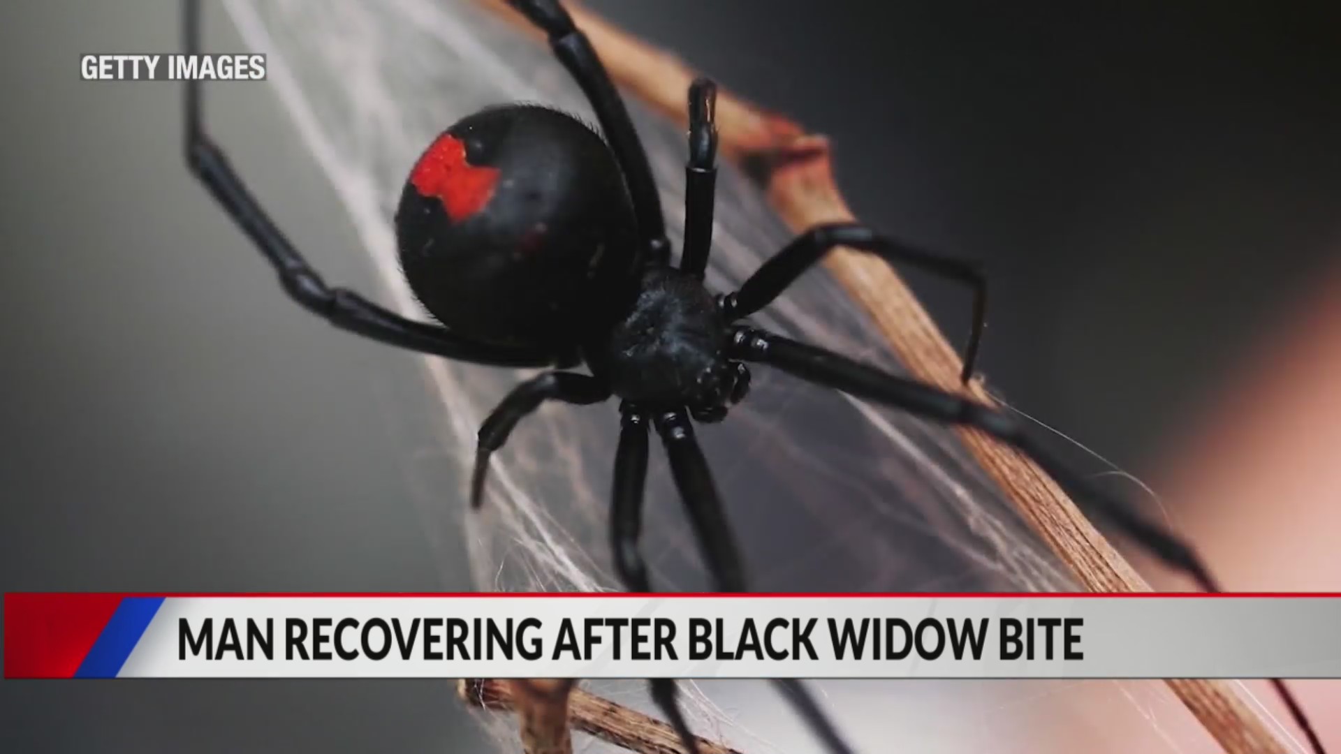 Man recovering after black widow bite – FOX31 Denver