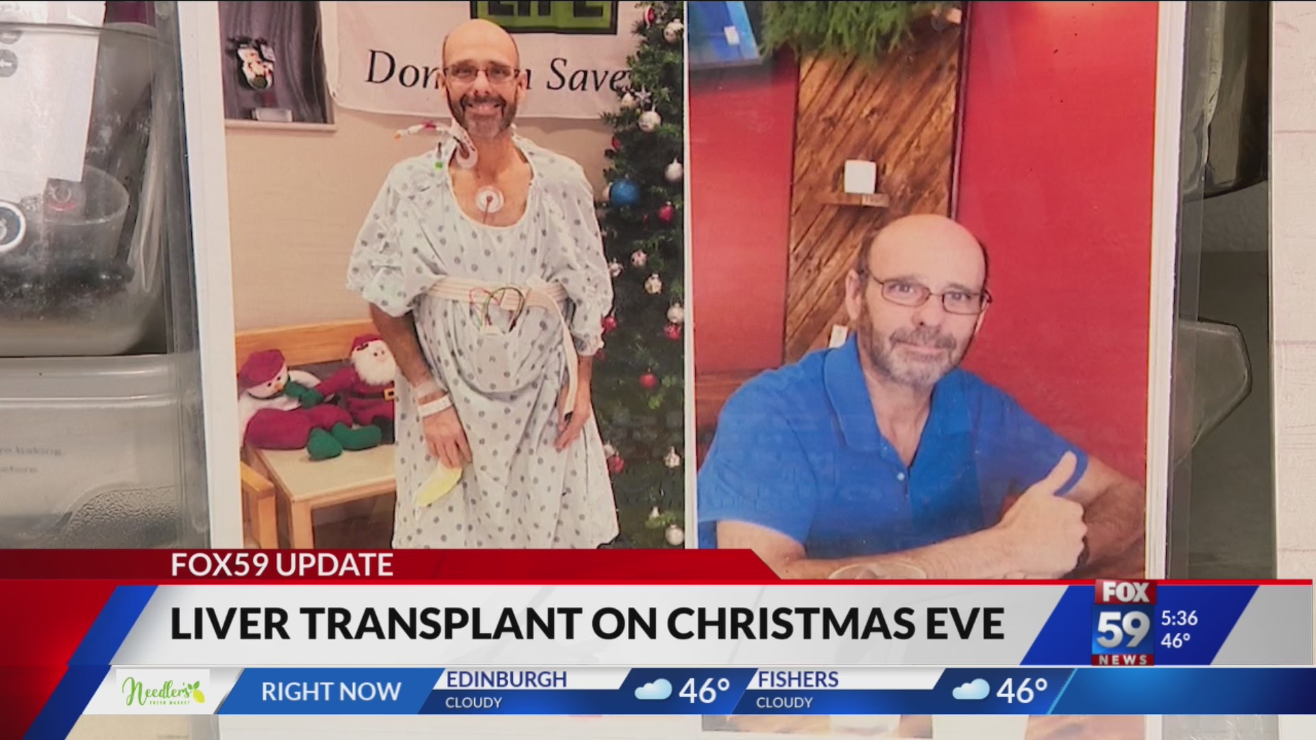 Indiana man receives liver transplant on Christmas Eve – Fox 59
